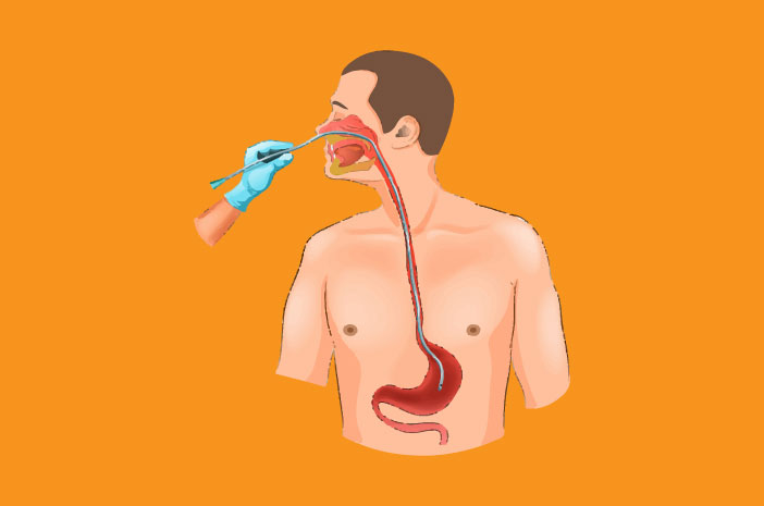 Ketahui Perawatan Nasogastric Tube di Rumah