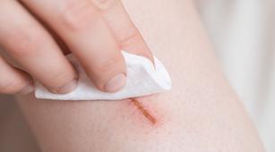 Pergaulan Seks Bebas Bisa Tularkan HIV, Ini Penjelasannya