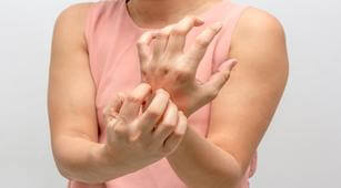 Ini Penyebab Timbulnya Ruam Kulit di Tangan